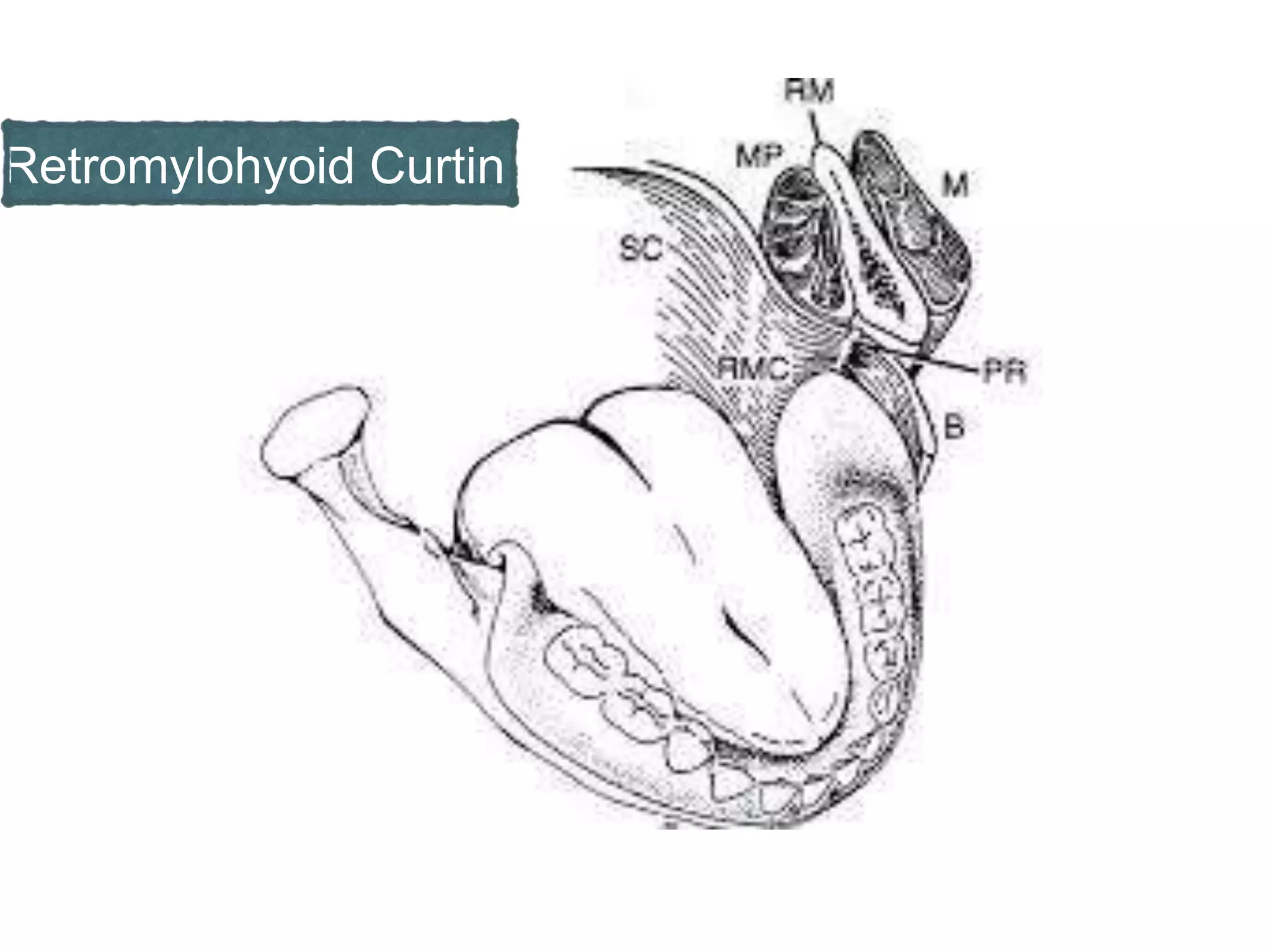 Maxillary and mandibular anatomical land marks | PPTX