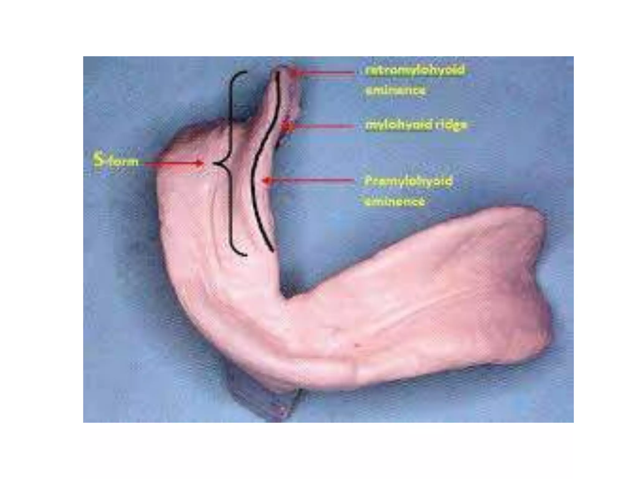 Maxillary and mandibular anatomical land marks | PPTX