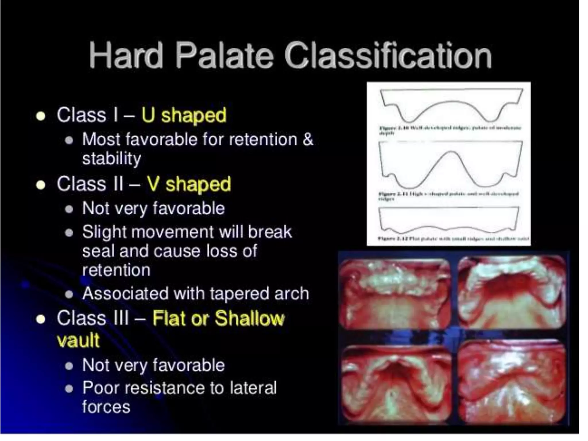 Maxillary and mandibular anatomical land marks | PPTX