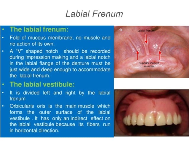 Maxillary and mandibular anatomical land marks | PPTX