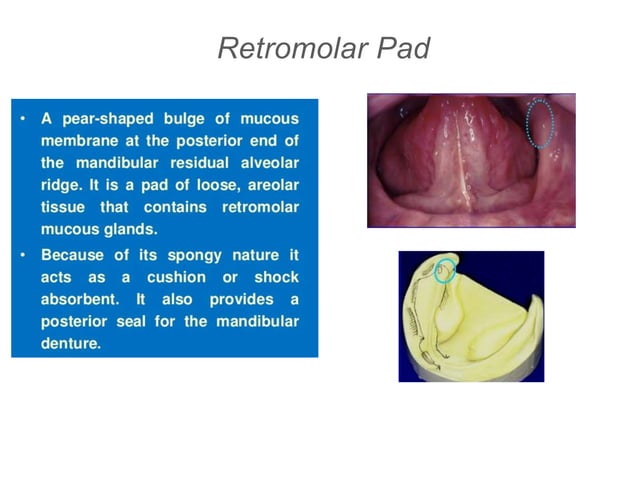 Maxillary and mandibular anatomical land marks | PPTX