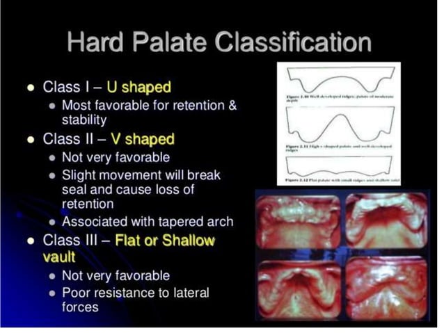 Maxillary and mandibular anatomical land marks | PPTX