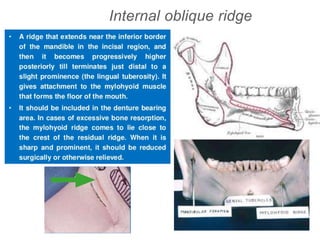 Internal Oblique Ridge