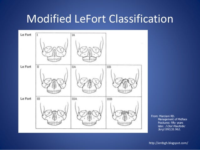 Maxillary and periorbital fractures