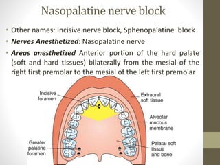 Nasopalatine Nerve Incisive