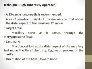 Maxillary Nerve Block High Tuberosity Approach