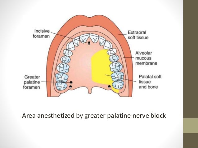 Maxillary anesthesia