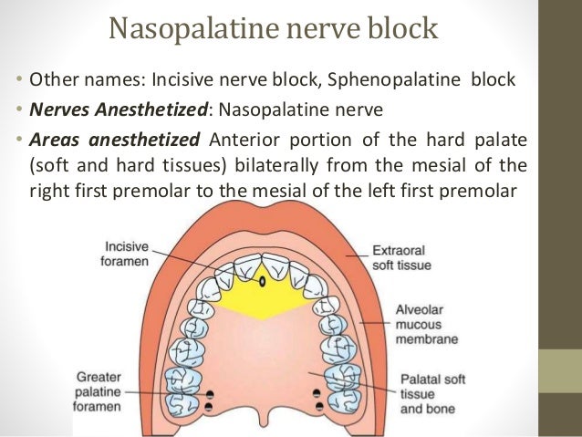 Maxillary anesthesia