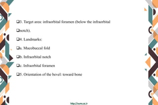 Maxillary anesthesia techniques | PDF