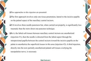 Maxillary anesthesia techniques | PDF