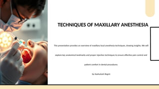 techniques of maxillary local anesthesia | PPTX