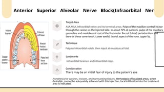 techniques of maxillary local anesthesia | PPTX