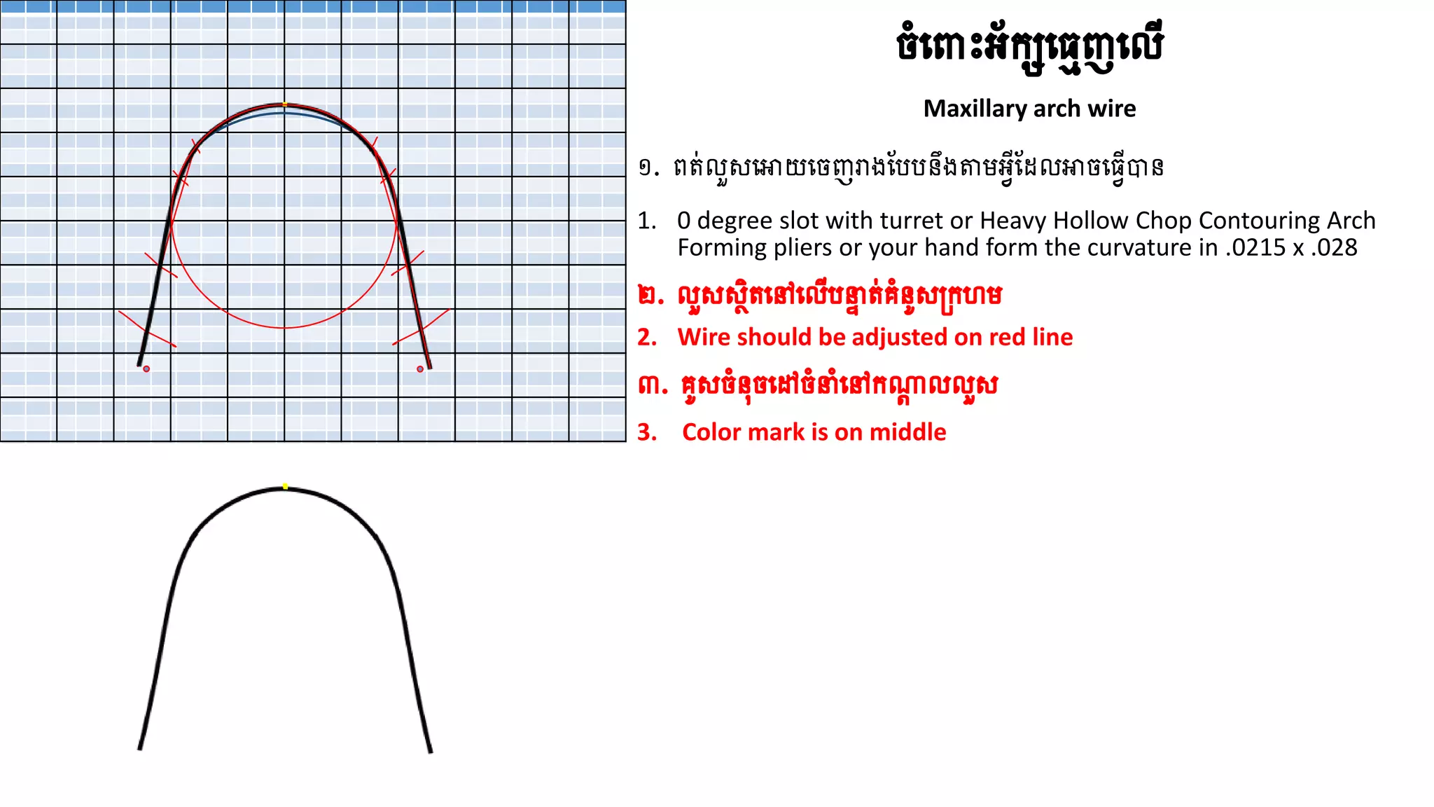 Maxillary arch form | PPT