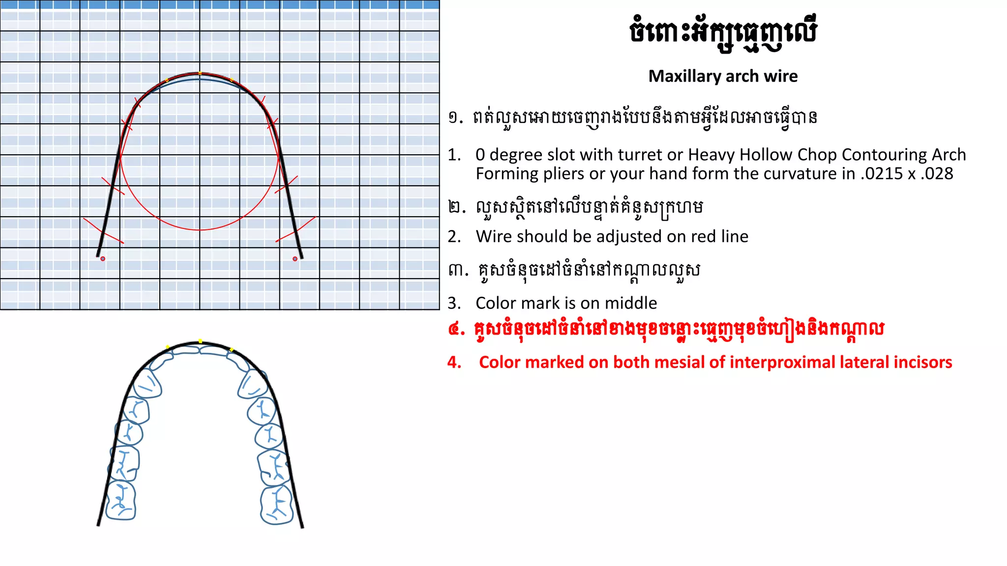 Maxillary arch form | PPT