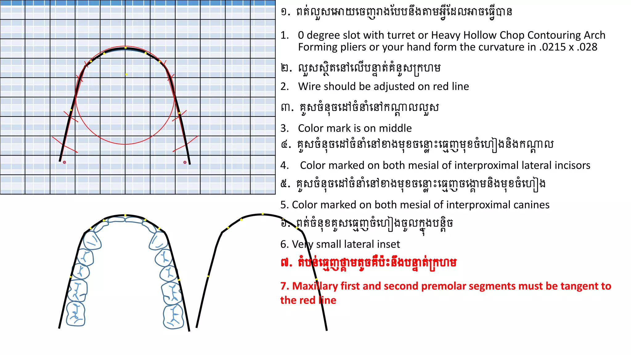 Maxillary arch form | PPT