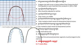 Maxillary arch form | PPT