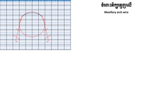Maxillary arch form | PPT