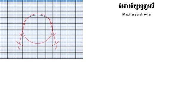 Maxillary arch form | PPT