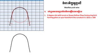 Maxillary arch form | PPT
