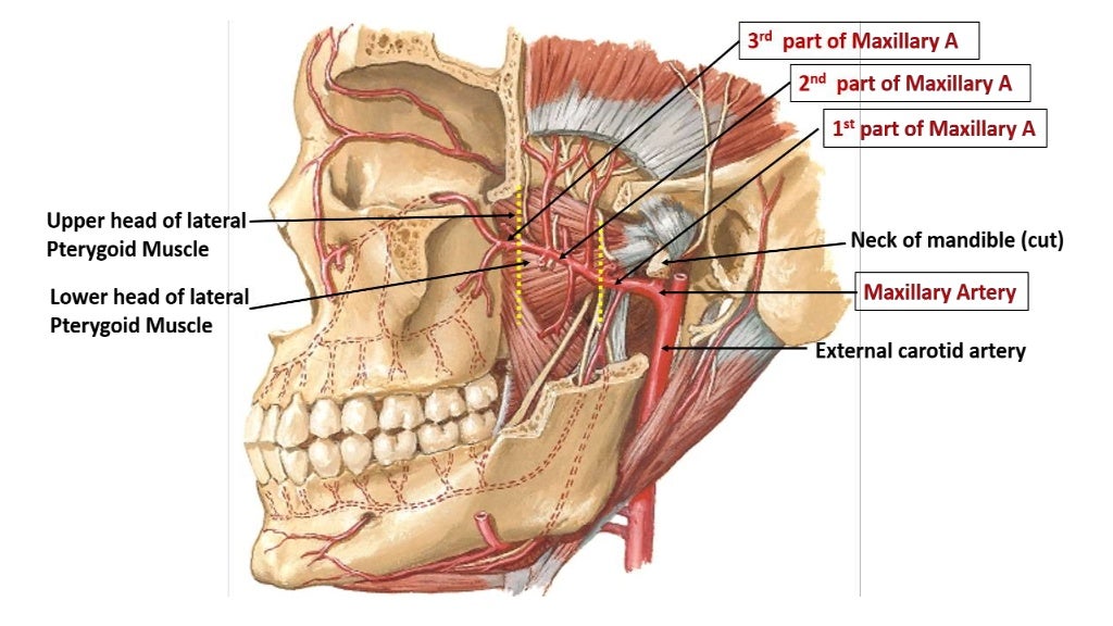 Maxillary artery, Mandibular nerve and Otic ganglion.pptx