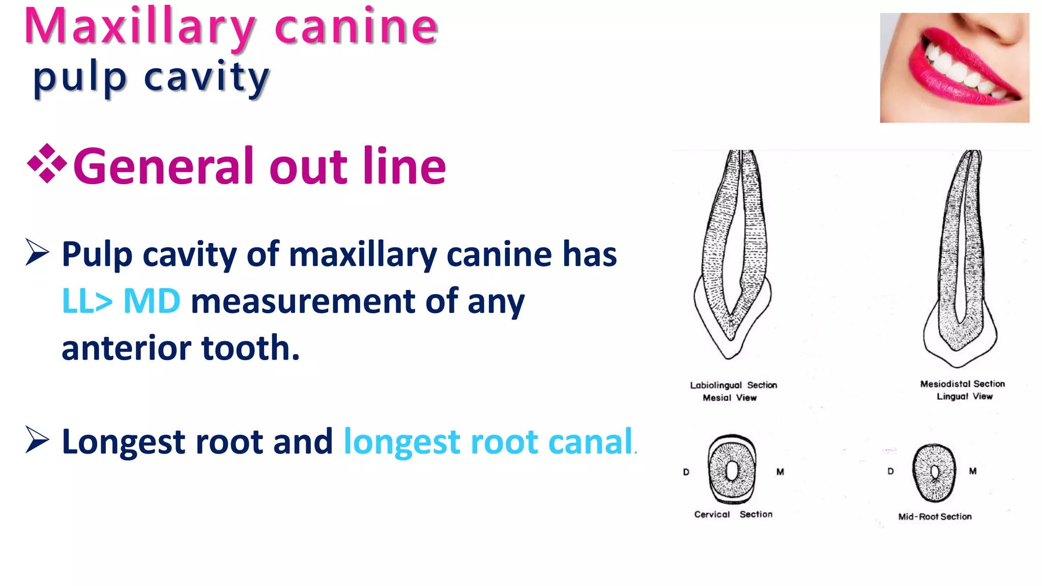 Maxillary canine | PPTX