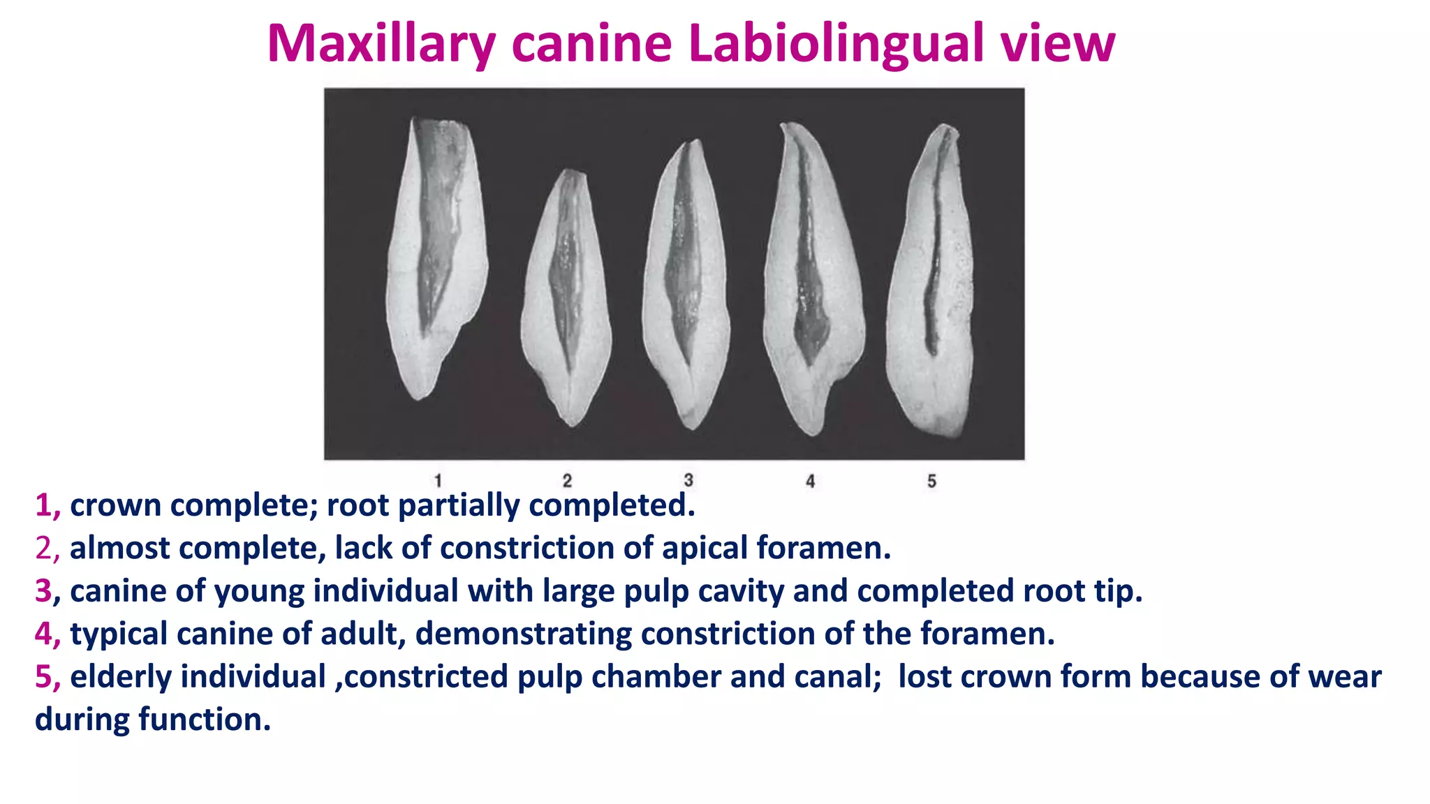 Maxillary canine | PPTX