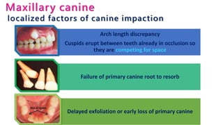 Maxillary canine | PPTX