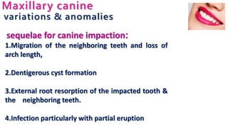Maxillary canine | PPTX