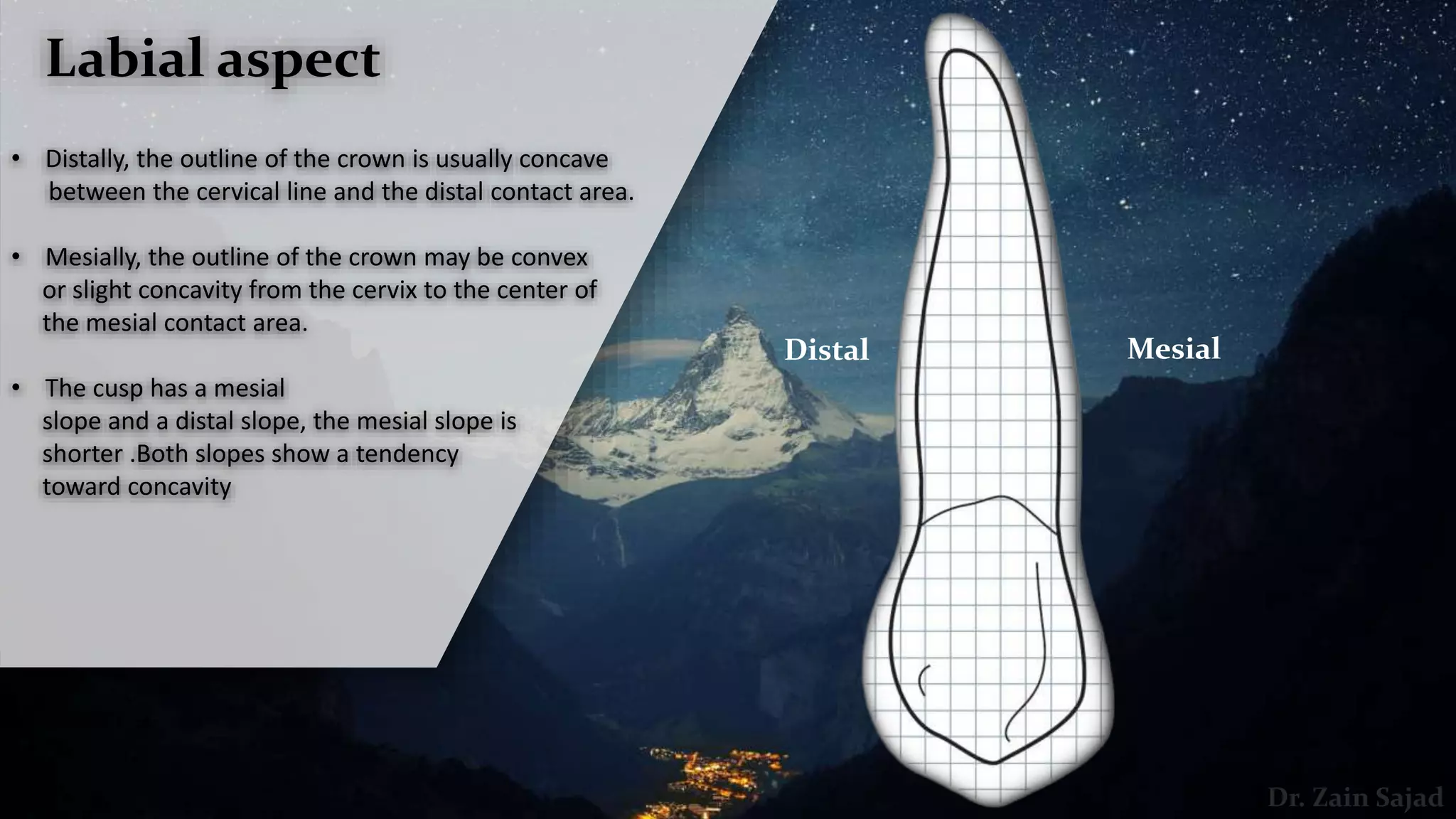 maxillary canine drawing.pptx