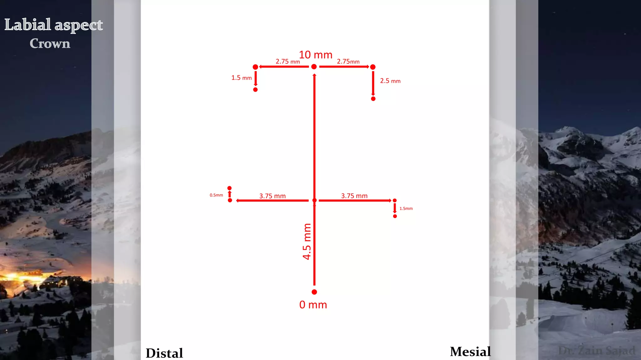 maxillary canine drawing.pptx