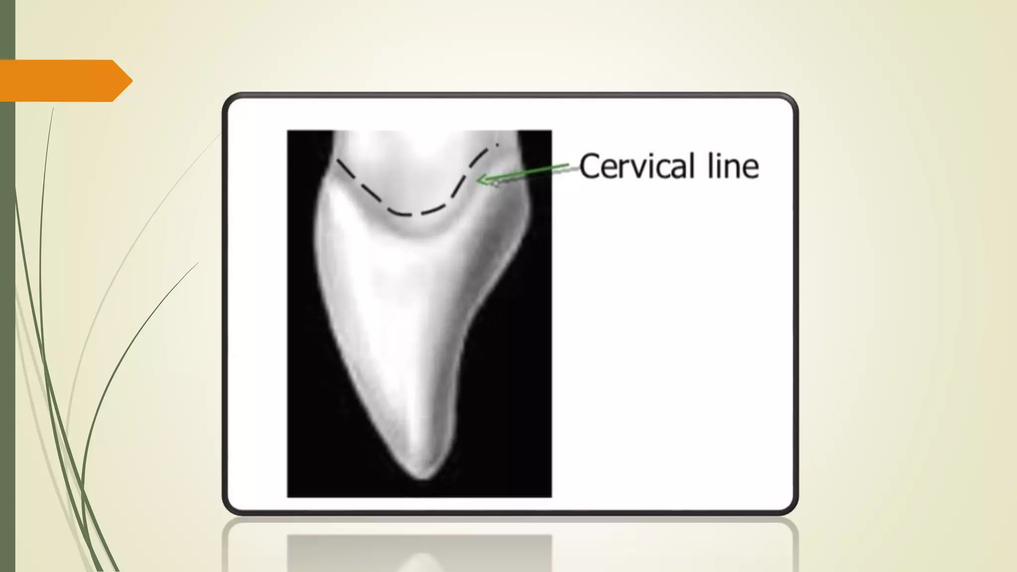 Maxillary central incisor (ORAL ANATOMY) | PPTX
