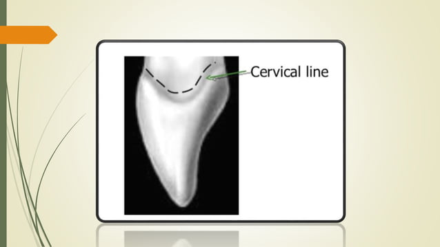 Maxillary central incisor (ORAL ANATOMY) | PPTX | Dental Health ...