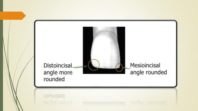 Maxillary central incisor (ORAL ANATOMY) | PPTX | Dental Health ...