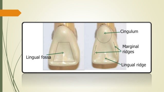 Maxillary central incisor (ORAL ANATOMY)