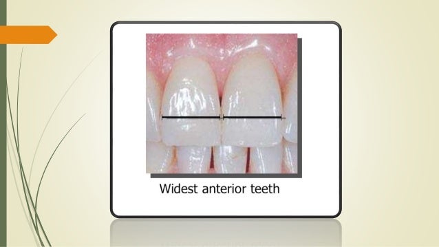 Maxillary central incisor (ORAL ANATOMY)