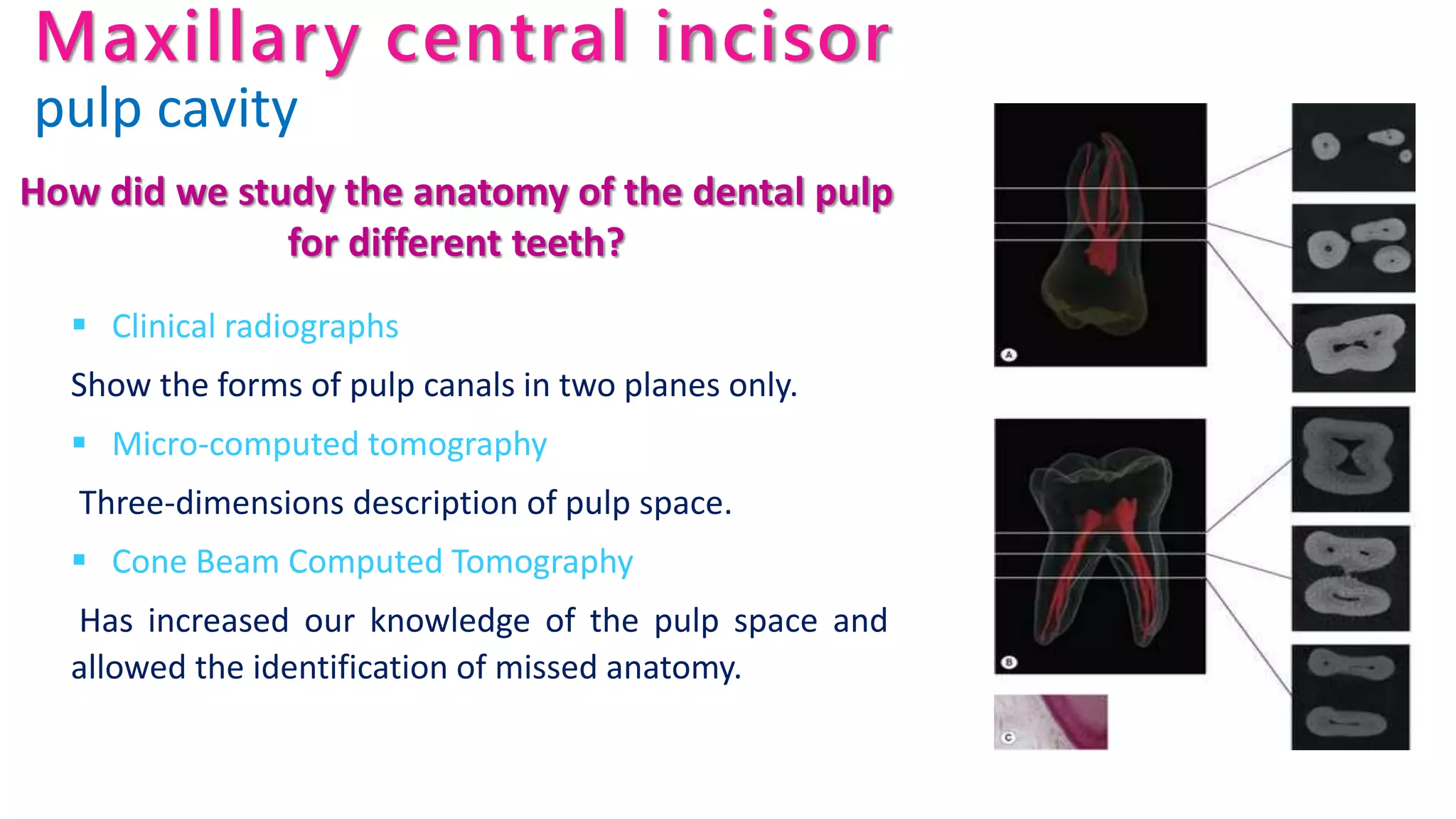 Maxillary central incisor | PPTX