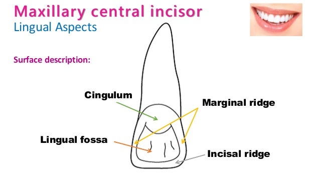 Maxillary central incisor