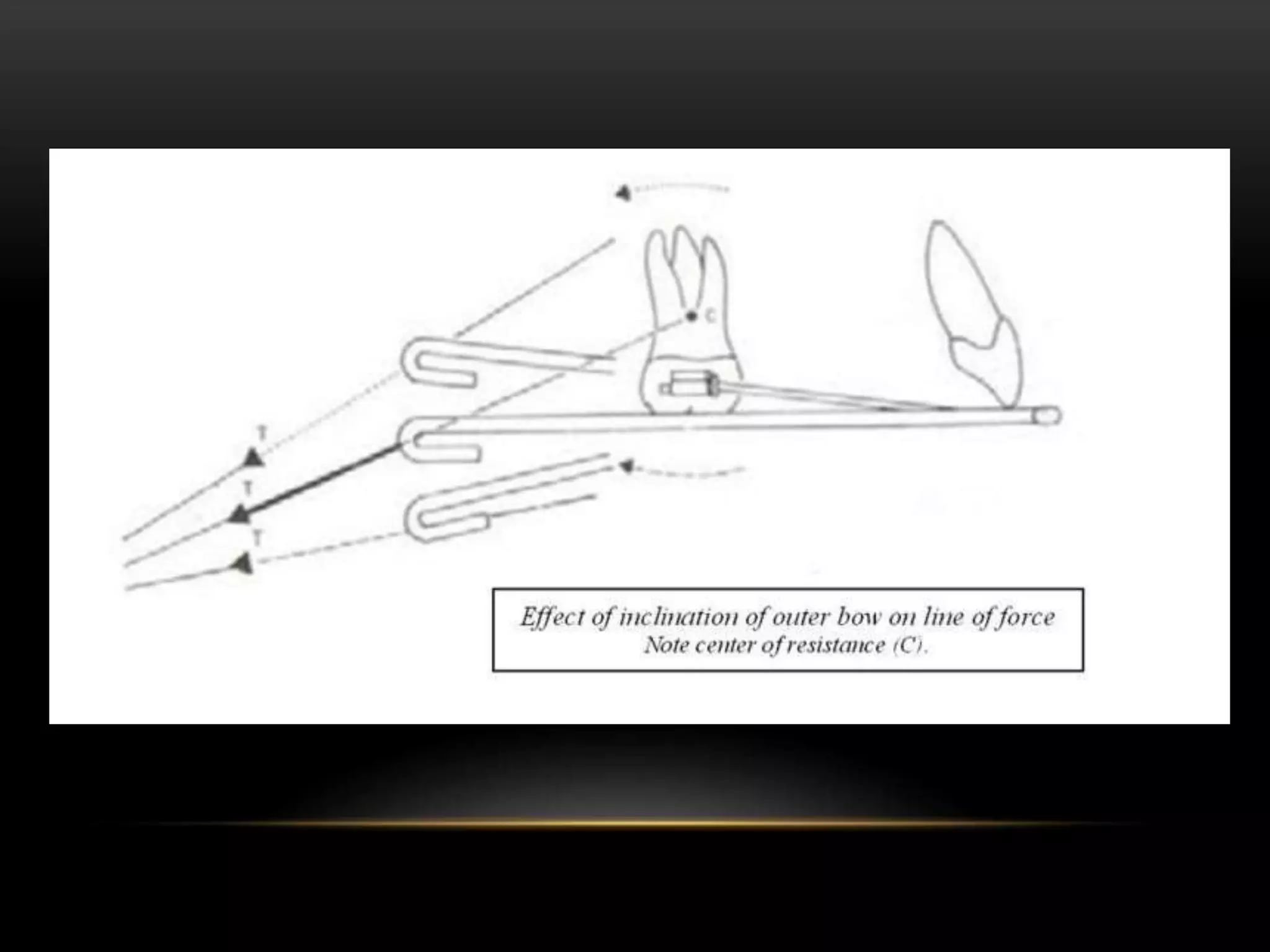 Maxillary distalizers | PPTX