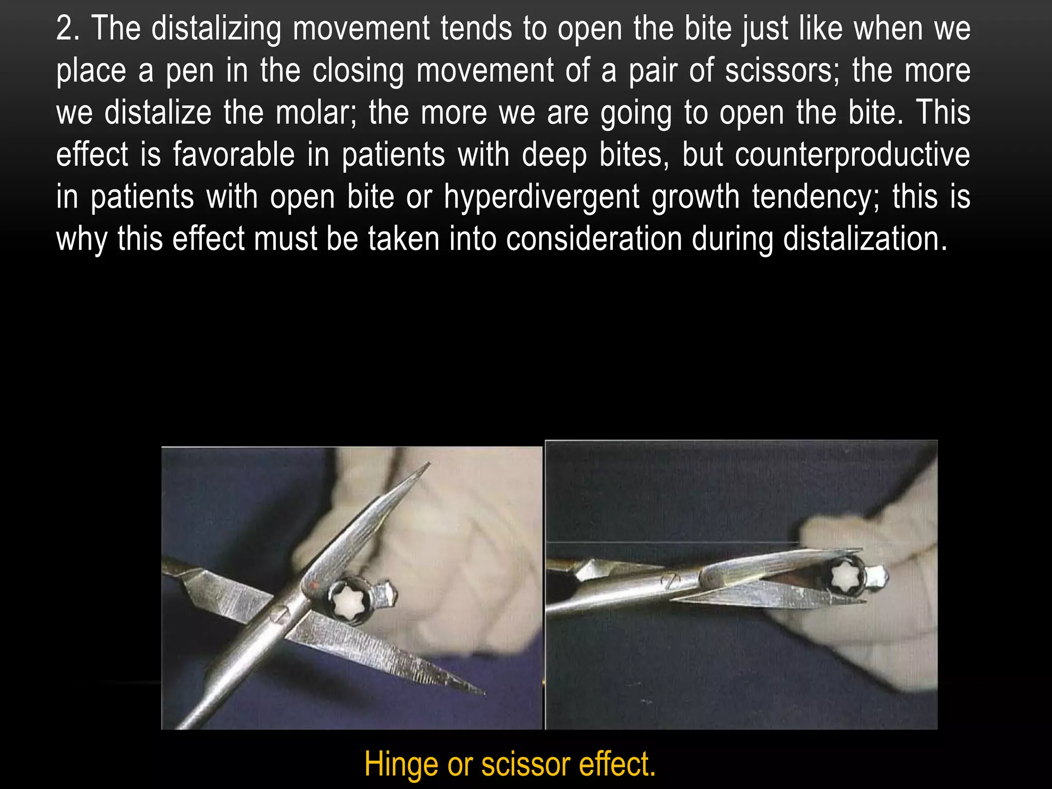Maxillary distalizers | PPTX