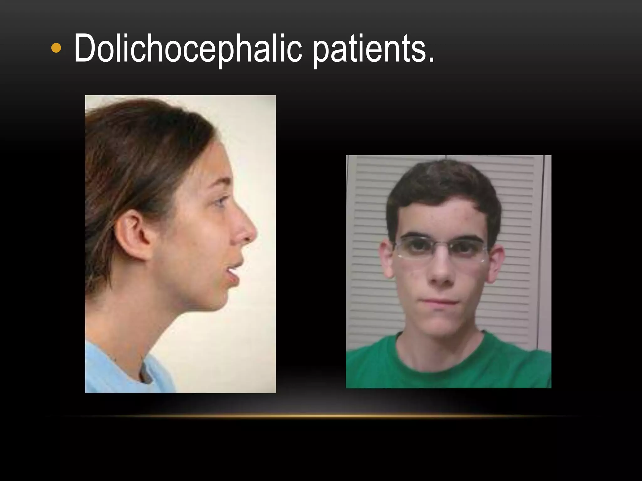 Maxillary distalizers | PPTX