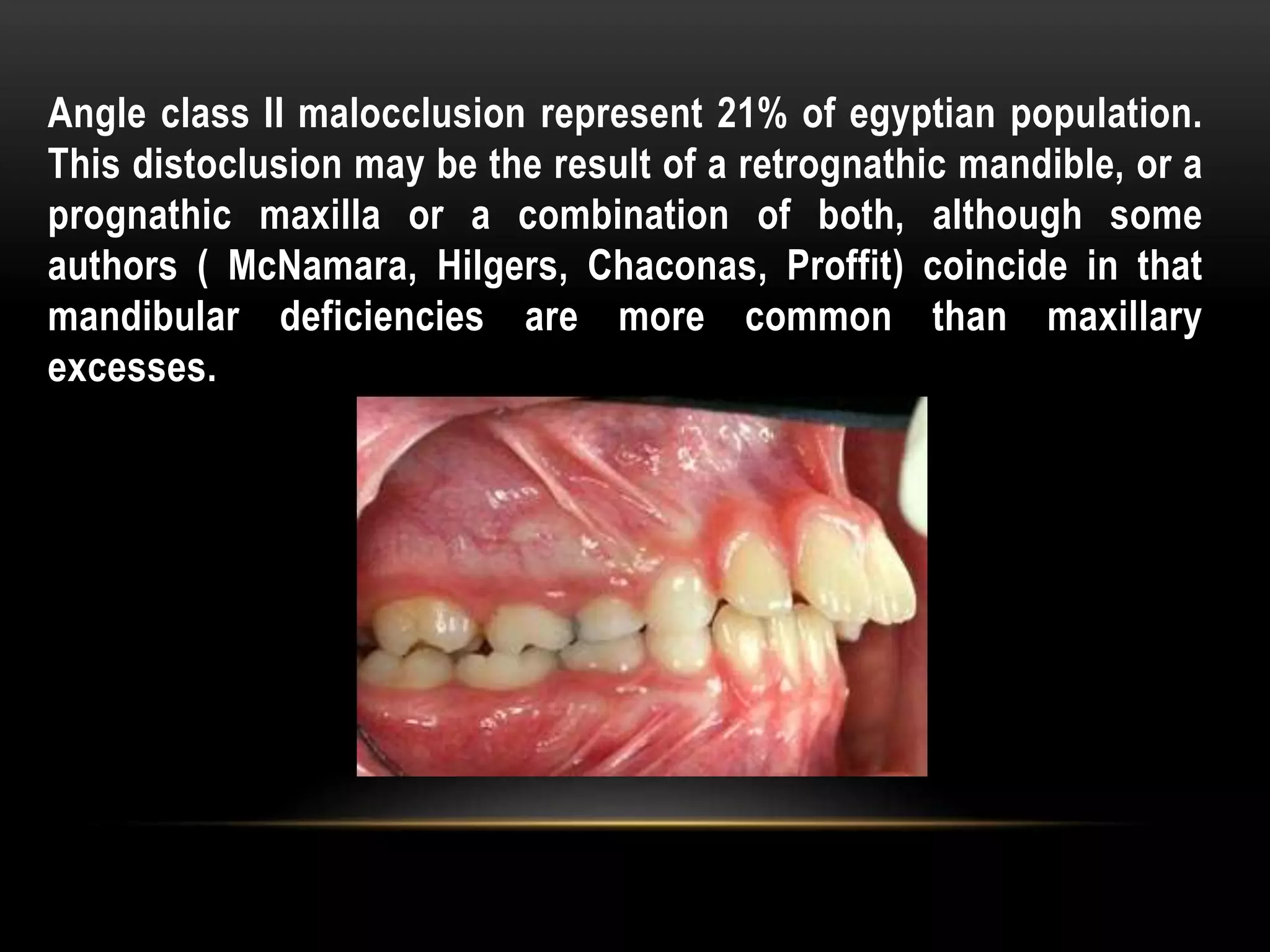 Maxillary distalizers | PPTX