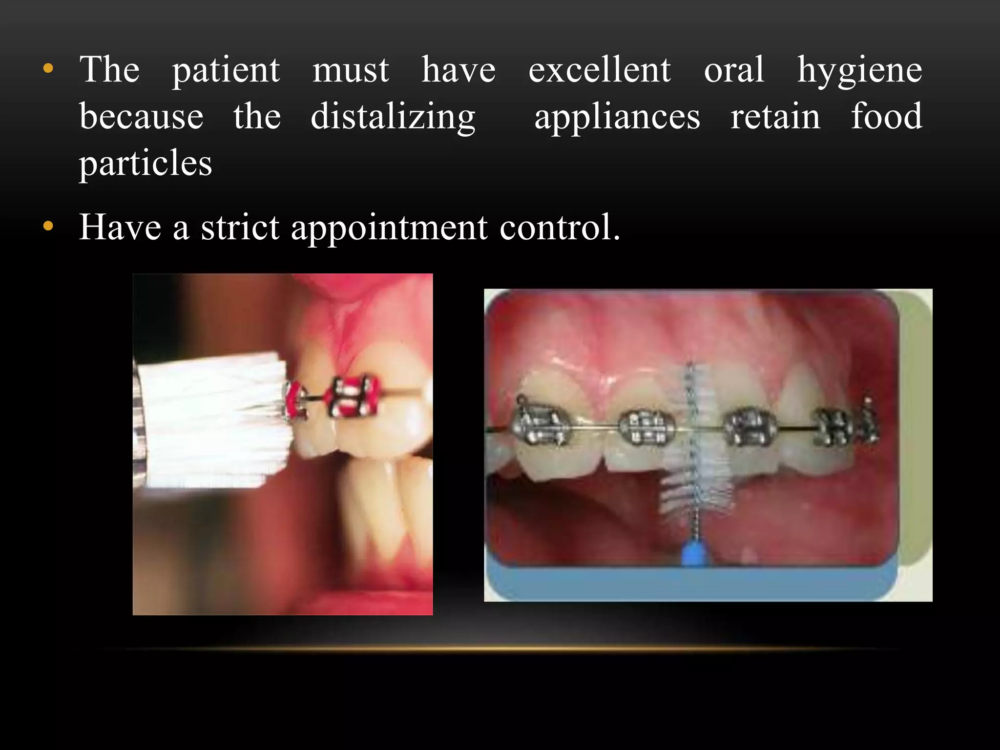 Maxillary distalizers | PPTX