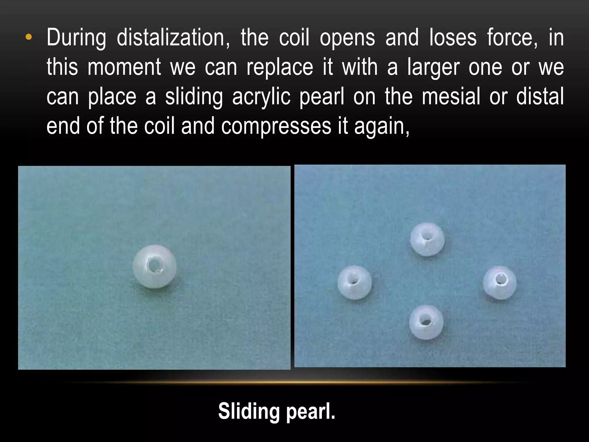 Maxillary distalizers | PPTX