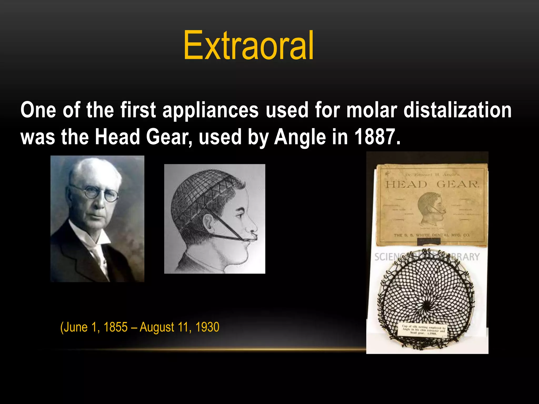 Maxillary distalizers | PPTX