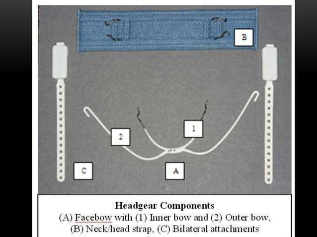 Maxillary distalizers | PPTX