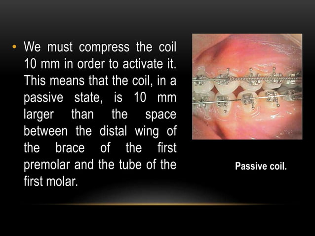 Maxillary distalizers | PPTX