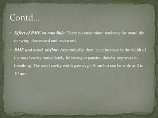 Maxillary expansion | PPTX