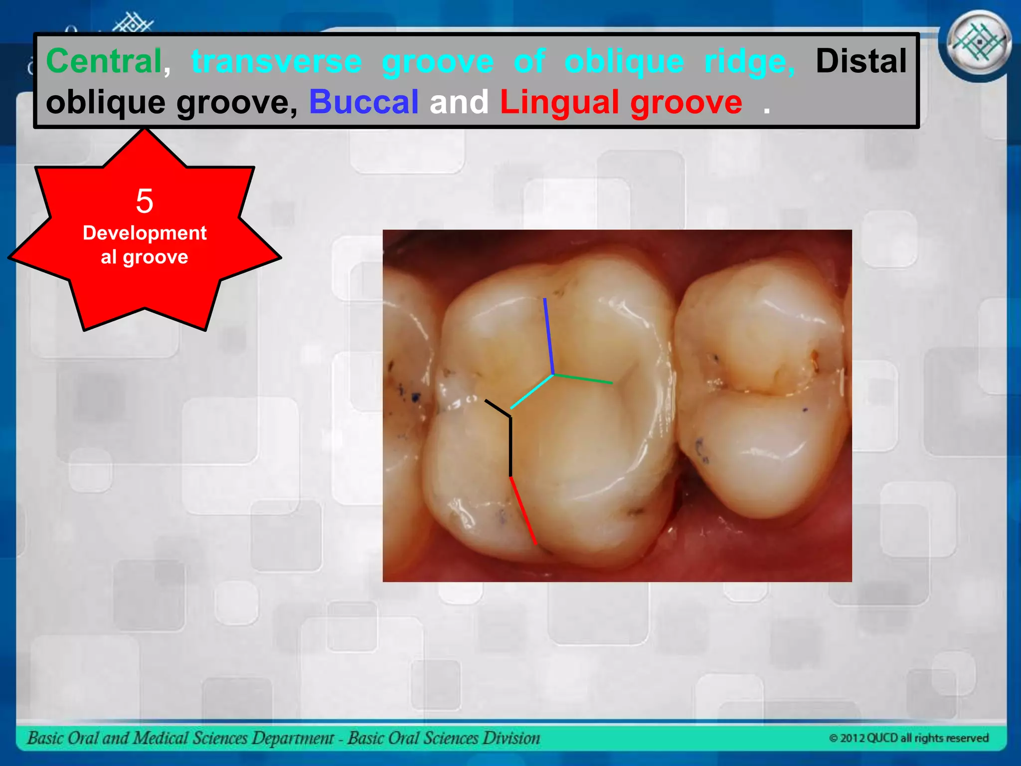 Maxillary first molar | PPTX