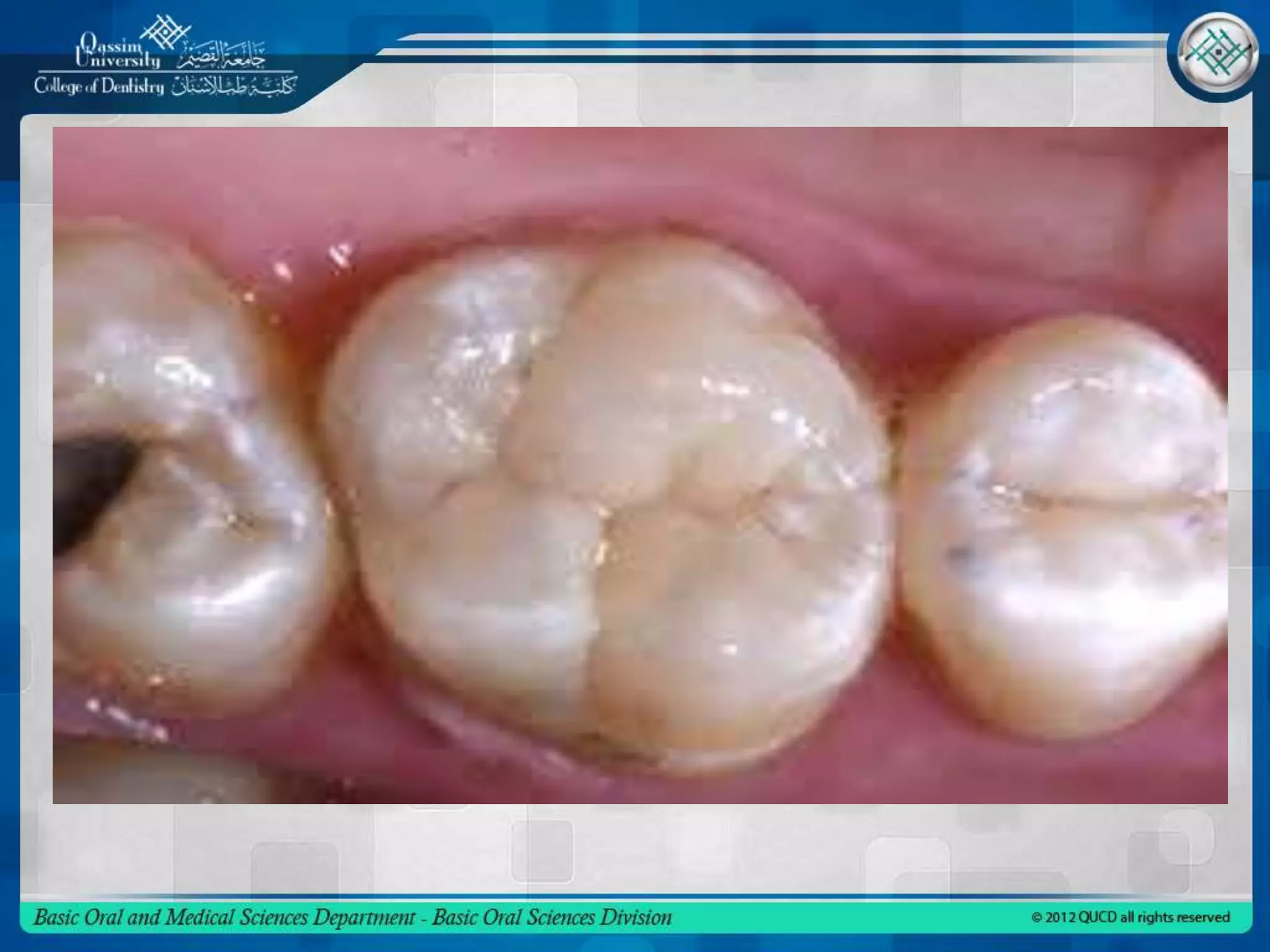 Maxillary first molar | PPTX