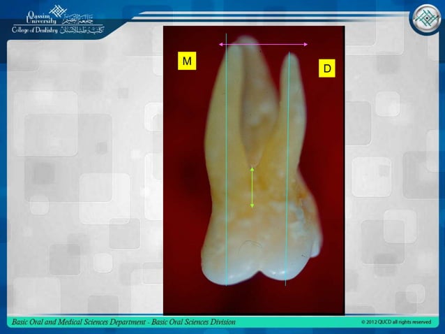 Maxillary first molar | PPTX